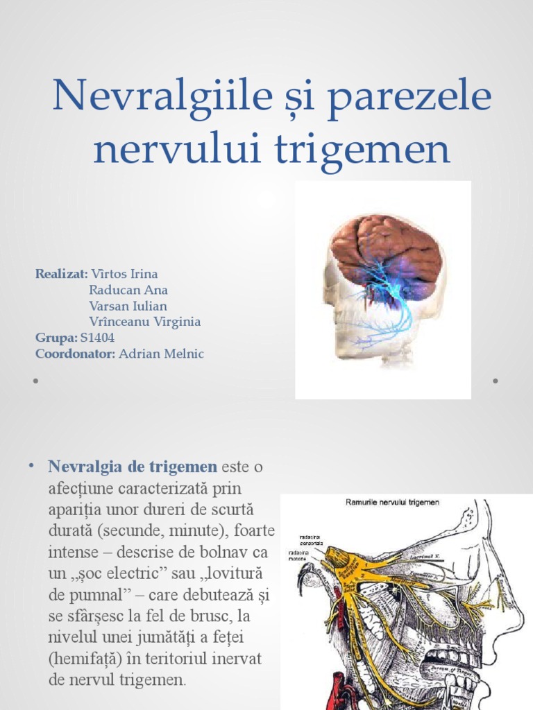 Nevralgiile Și Parezele N.trigemen | PDF