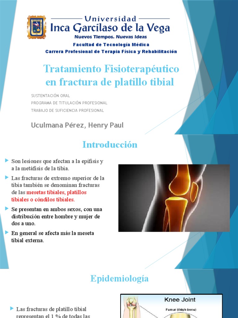 Tratamiento Fisioterapéutico en Fractura de Platillo Tibial | Descargar ...