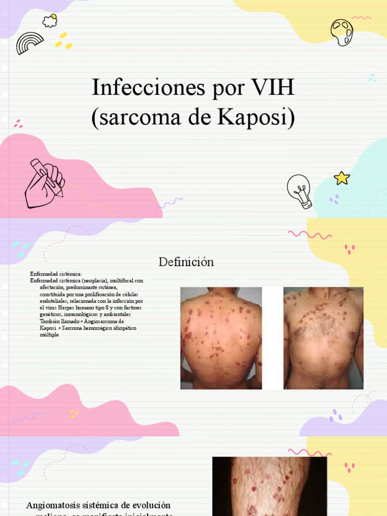 Infecciones Por VIH (Sarcoma de Kaposi) | PDF | Sarcoma | Especialidades Medicas