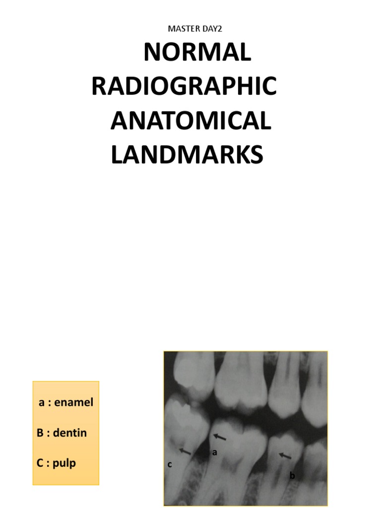 Normal Radiographic Anatomical Landmarks: Master Day2 | PDF | Human ...