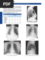 Cusack Protocol .. Supplement Dosages Information Chart. Word PDF | PDF ...