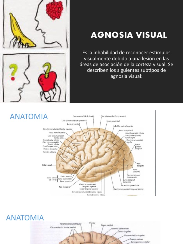 Agnosia Visual | PDF | Percepción visual | Lóbulo occipital