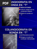 Colangiografía por Sonda T: Guía Completa | PDF | Bilis | Hígado