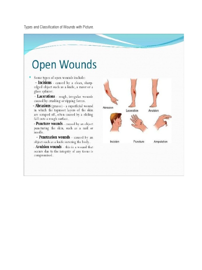 Types and Classifications of Wounds | PDF