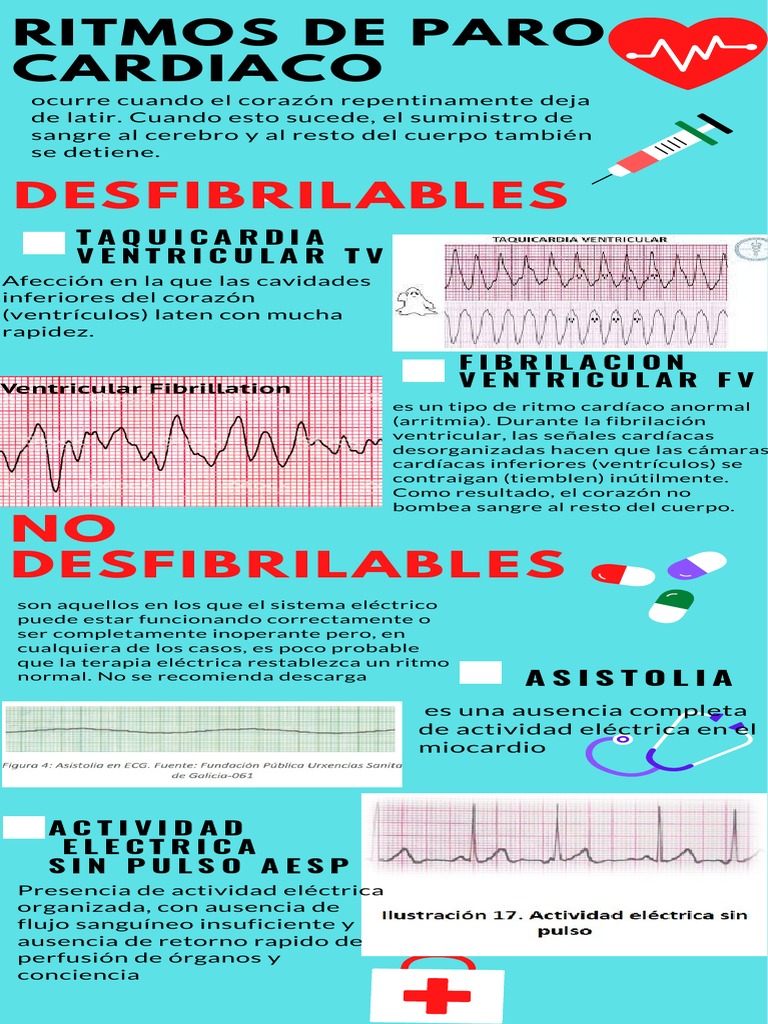 Ritmos Cardíacos: Desfibrilables y No Desfibrilables | PDF