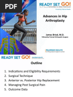 Accolade System Surgical Technique | PDF | Hip | Anatomical Terms Of Motion