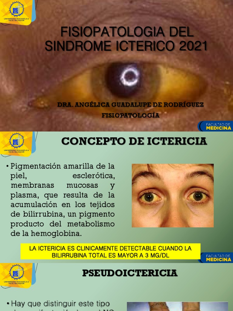 Fisiopatologia de SX Icterico | PDF | Cirrosis | Hepatitis