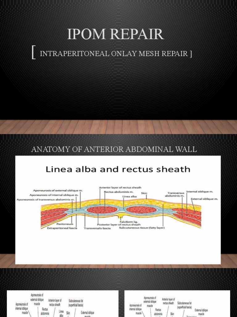 Ipom Repair (: Intraperitoneal Onlay Mesh Repair) | PDF | Surgery | Medicine