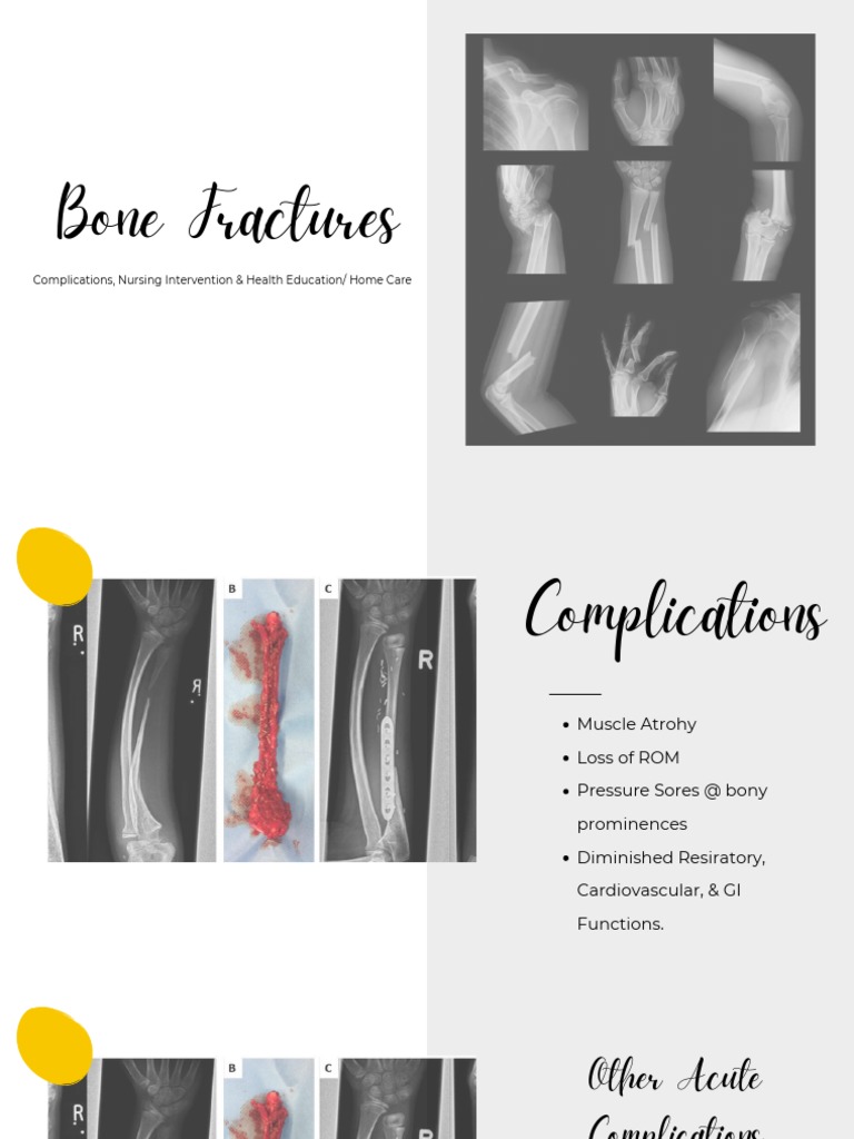Bone Fractures: Complications, Nursing Intervention & Health Education ...