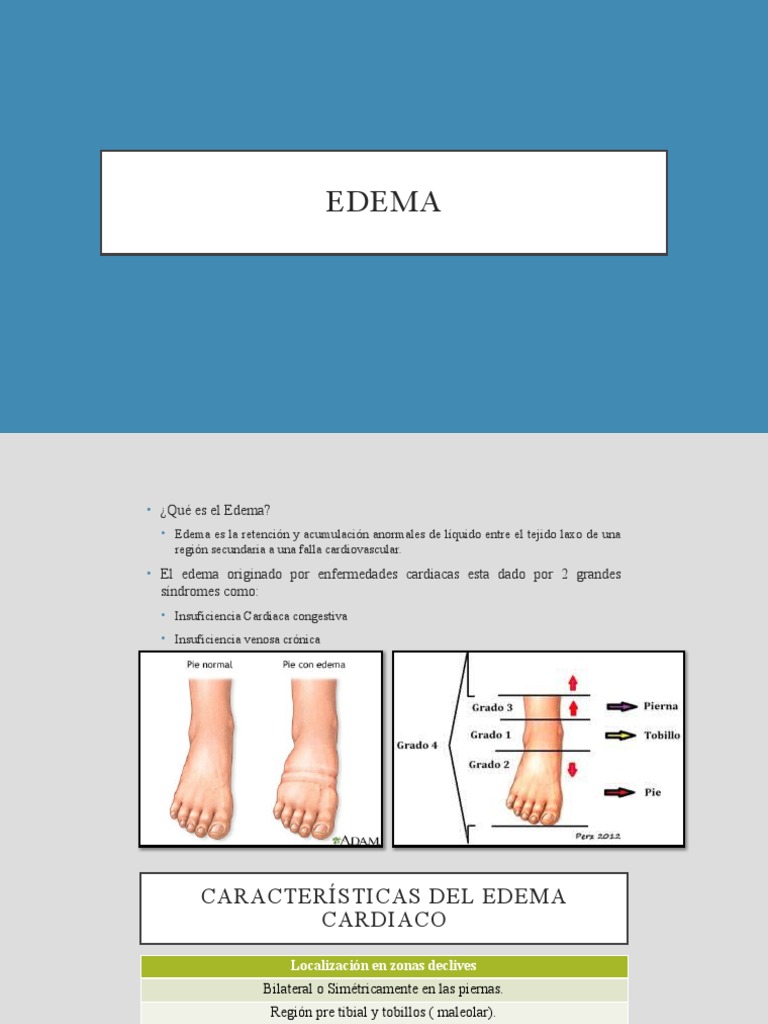 Edema Cardiaco: Causas y Características | PDF | Edema | Insuficiencia ...