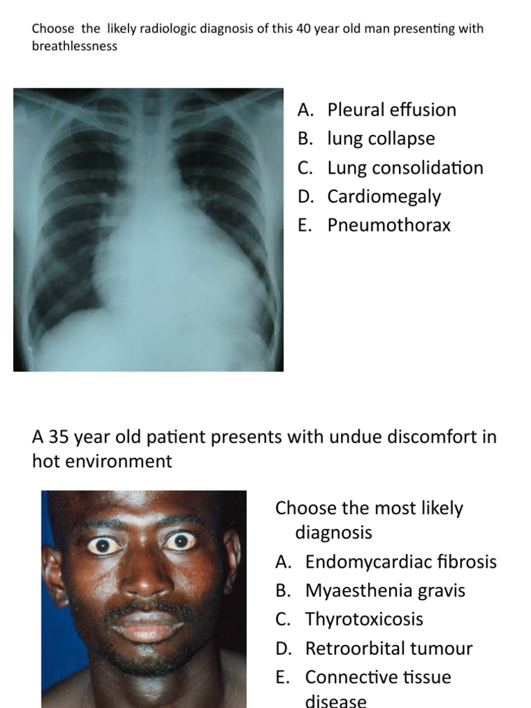 MDCN PICTURE TEST - Internal Medicine | PDF | Clinical Medicine ...