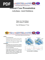 Ecg Interpretation J Point Stemi Criteria Equivalents and Others | PDF ...