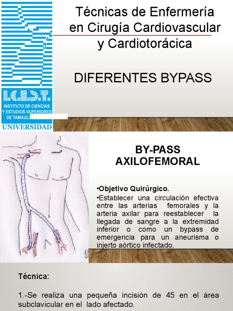 Tipos de Bypass | PDF | Cirugía de bypass de la arteria coronaria | Artería