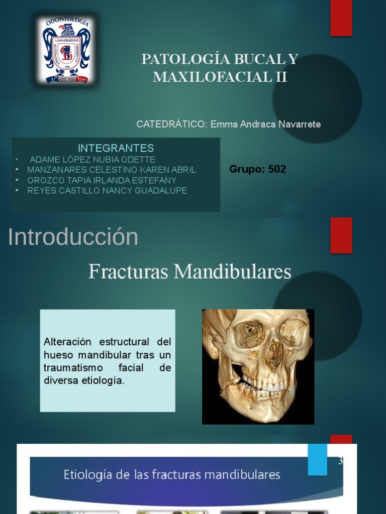Fracturas Mandibulares | PDF | Especialidades Quirúrgicas ...