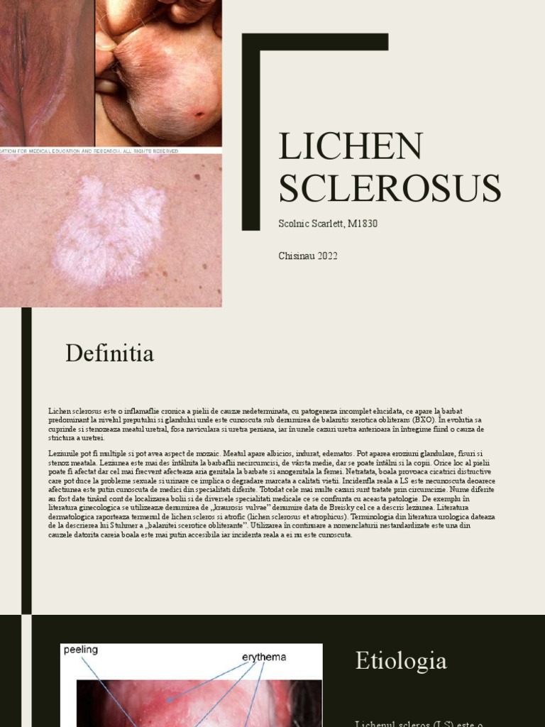 Lichen Sclerosus | PDF