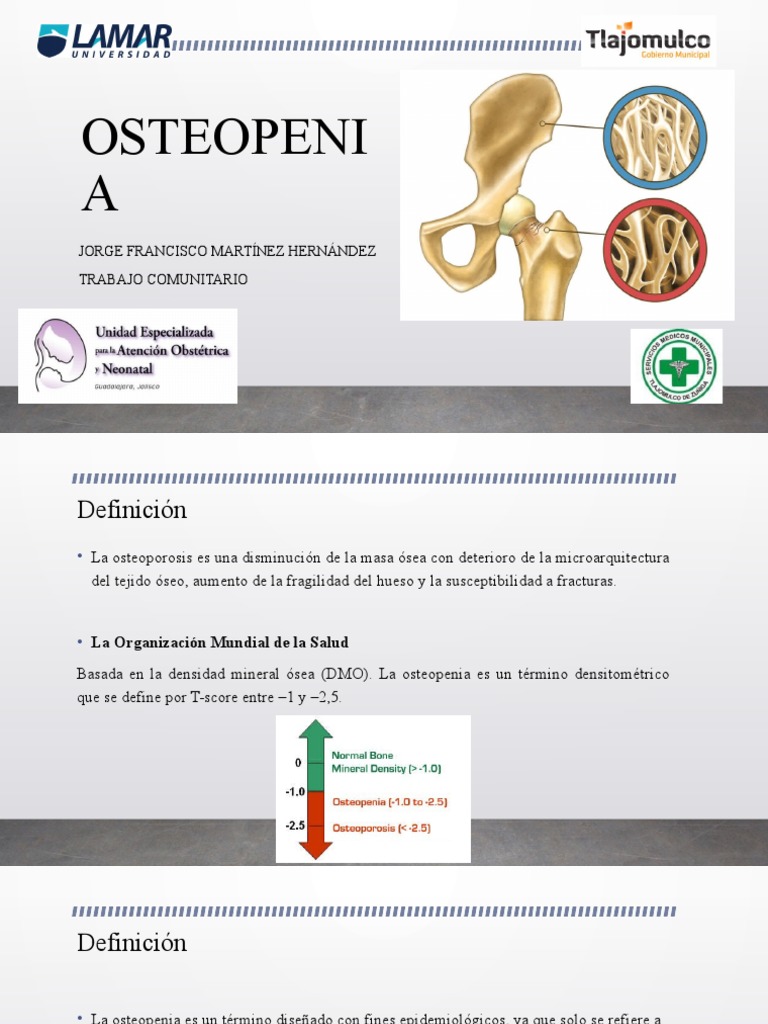 OSTEOPENIA | PDF | Osteoporosis | Hueso