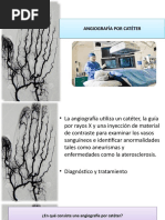Catéter de Fogarty | PDF | Especialidades Medicas | Medicina CLINICA