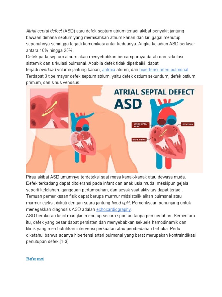 Atrial Septal Defect (ASD): Etiologi, Patofisiologi, dan ...