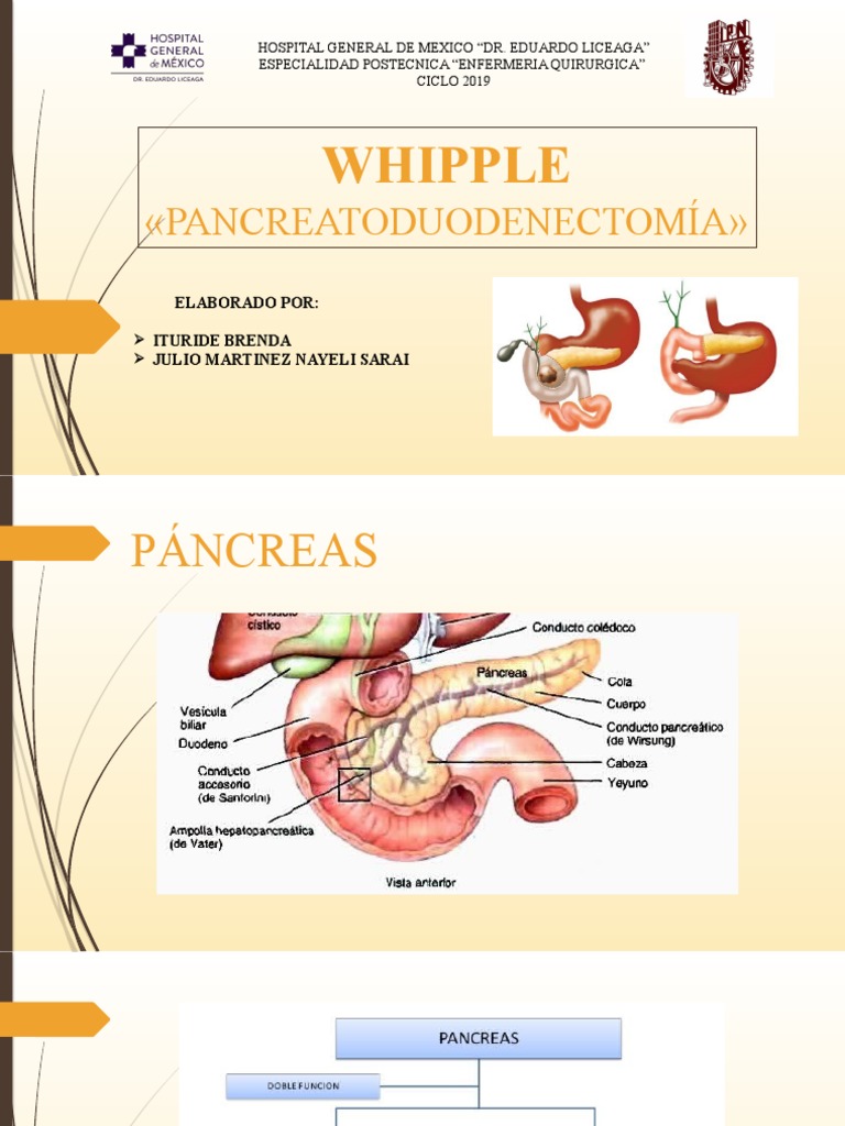 Whipple | PDF | Páncreas | Sistema digestivo humano