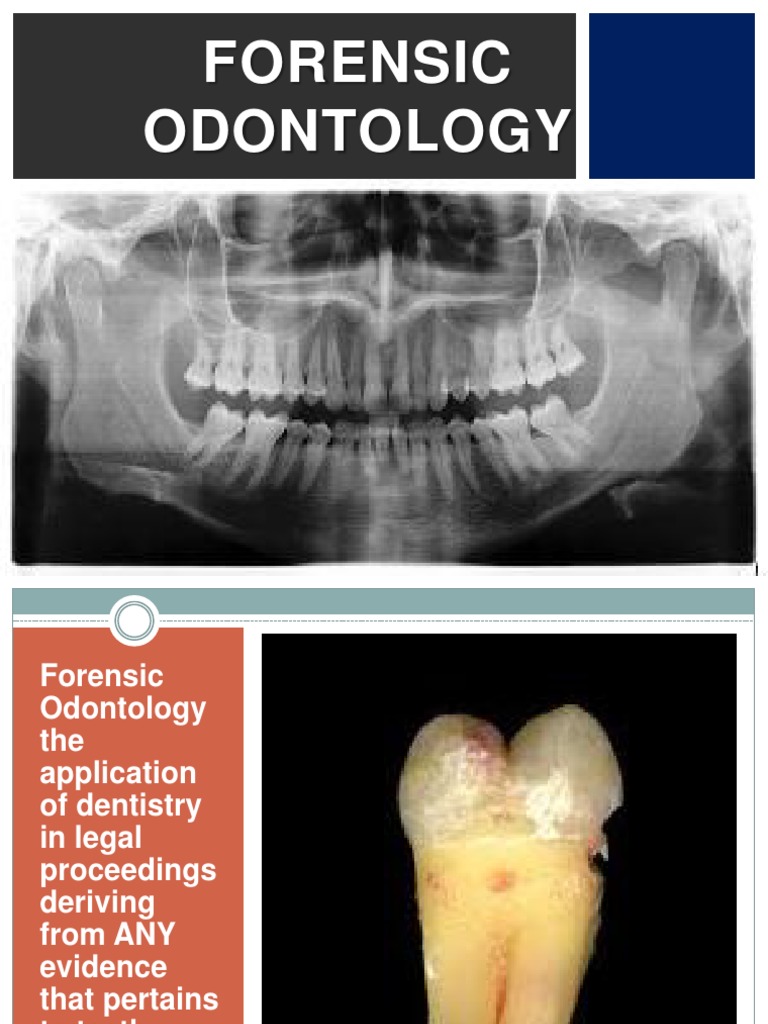 Forensic Odontology: Dental Evidence in Law | PDF | Dental Anatomy ...