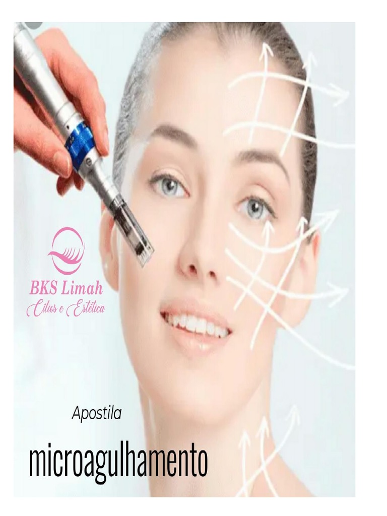 Técnica de microagulhamento: conceito, mecanismo de ação e ...