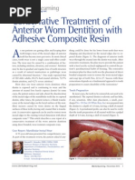 Monobond Plus - Instructions For Use | PDF | Water | Materials