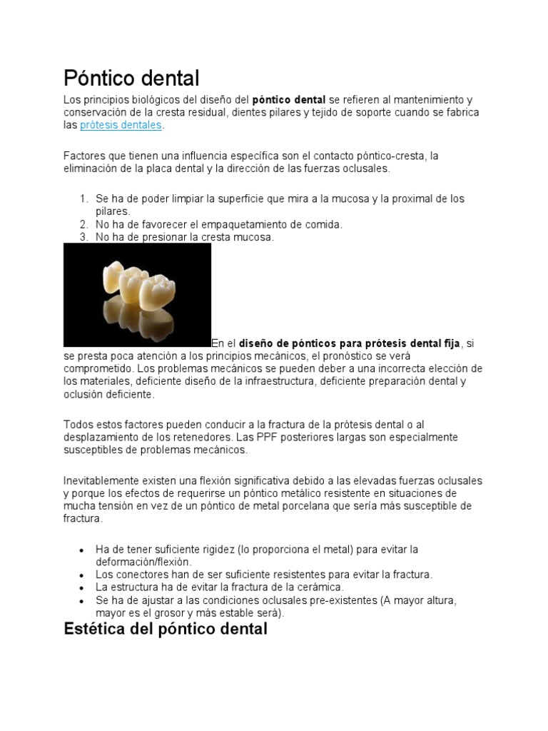 Principios biológicos y mecánicos en el diseño de pónticos dentales ...