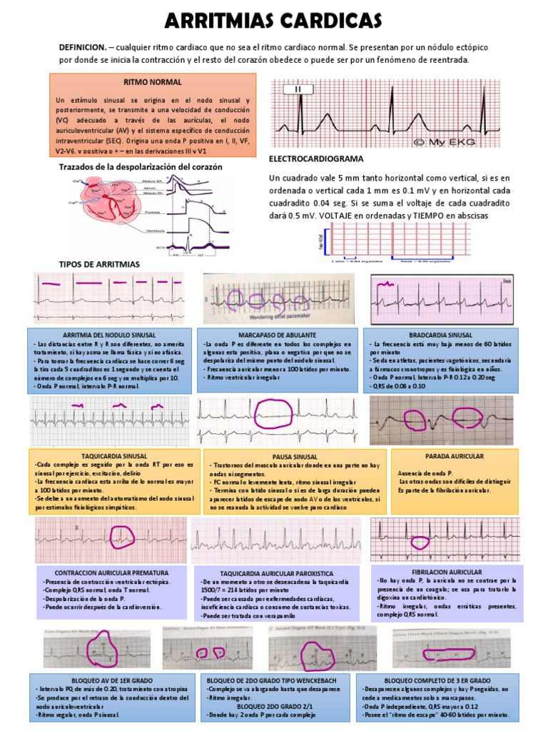 Arritmias Cardiacas | PDF | Electrofisiología cardíaca | Arritmia cardiaca