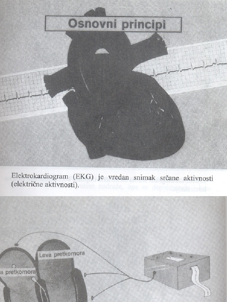 Dubin Ekg Serbian | PDF