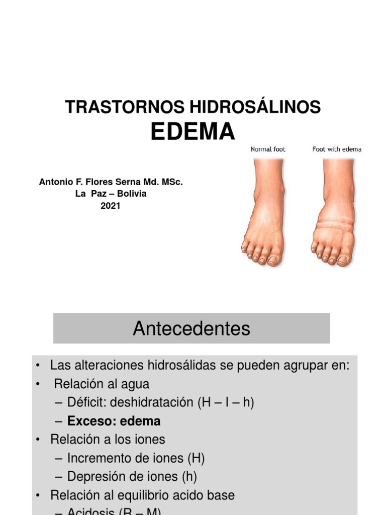 Edema | PDF | Edema | Especialidades Medicas