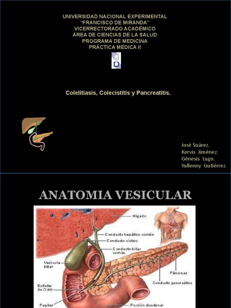 Colelitiasis, Colecistitis y Pancreatitis. | Descargar gratis PDF ... Colelitiasis, Colecistitis y Pancreatitis. | Descargar gratis PDF ...