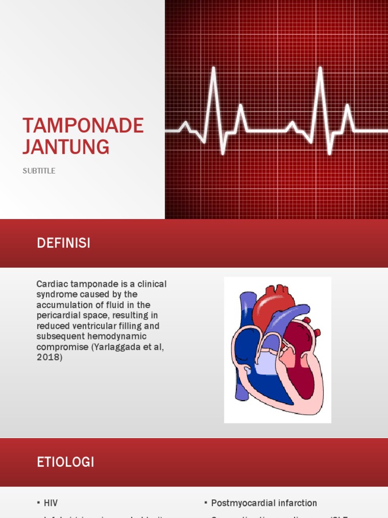 Tamponade Jantung | PDF