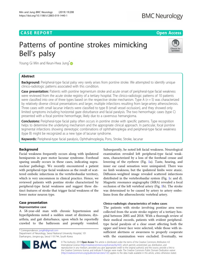 Bells Palsy Stroke-Mimics - 2019 | PDF | Stroke | Cerebellum