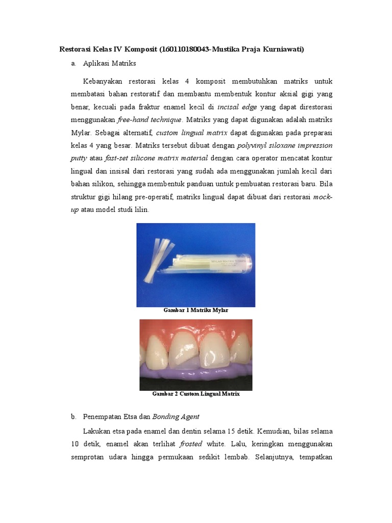Restorasi Kelas IV Komposit | PDF
