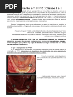 Grampos em PPR - Resumo | PDF | Dente