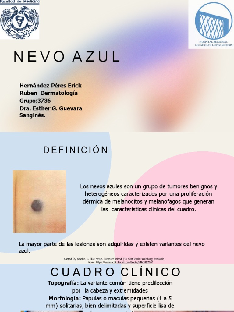 Nevo Azul | PDF | Neoplasias | Enfermedades y trastornos