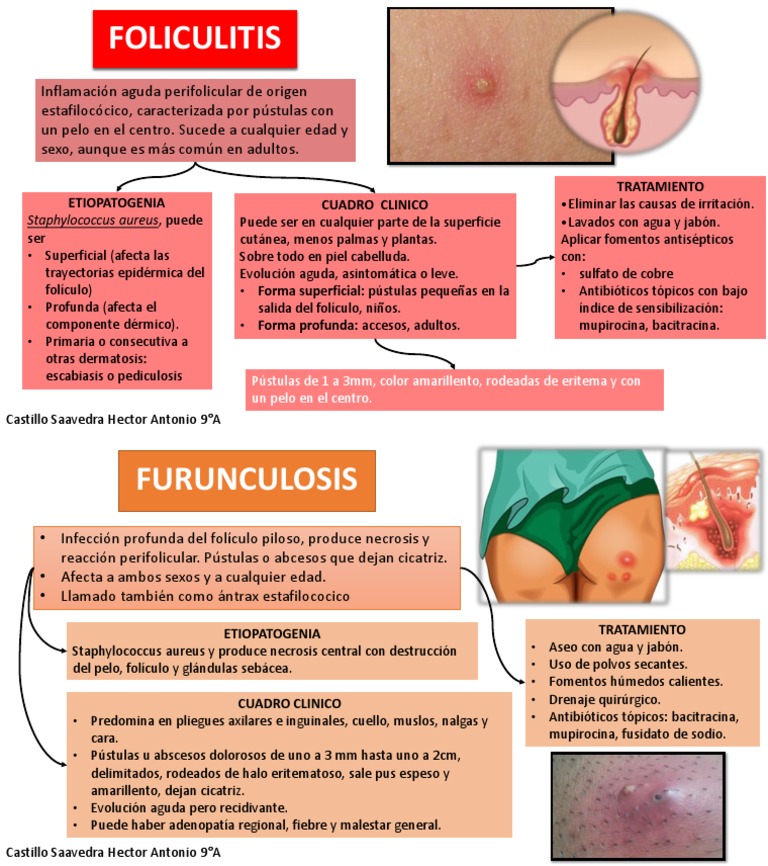 Foliculitis y Furunculosis | PDF | Especialidades Medicas | Enfermedades y trastornos