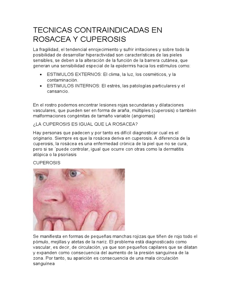 Tecnicas Contraindicadas en Rosacea y Cuperosis | PDF | Productos ...