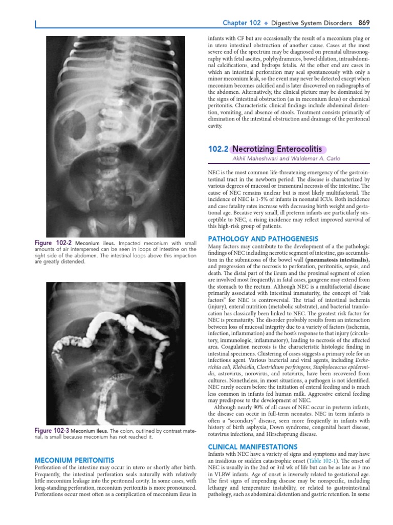Necrotizing Enterocolitis: Pathology and Pathogenesis | PDF | Preterm ...