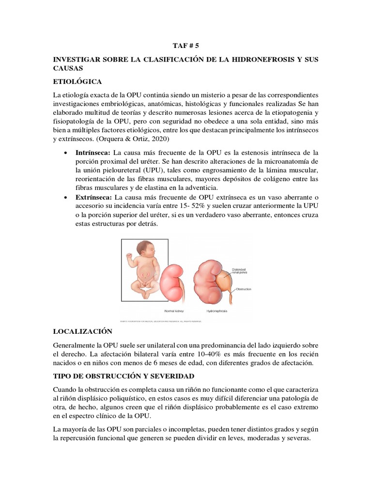Nvestigar Sobre La Clasificación de La Hidronefrosis y Sus Causas | PDF ...