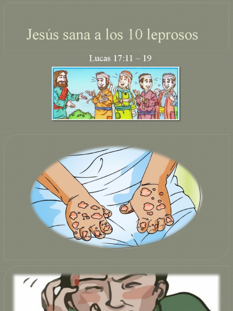 Jesús Sana A Los 10 Leprosos | PDF