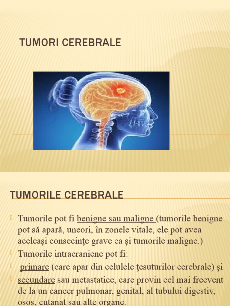 Tumori Cerebrale | PDF