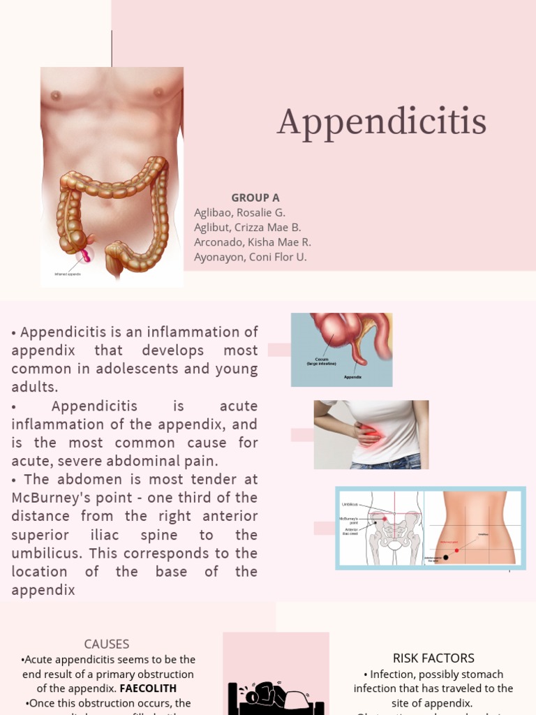 APPENDICITIS | PDF | Surgery | Clinical Medicine