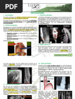 Niveles Axilares de Berg | PDF | Finanzas y dinero
