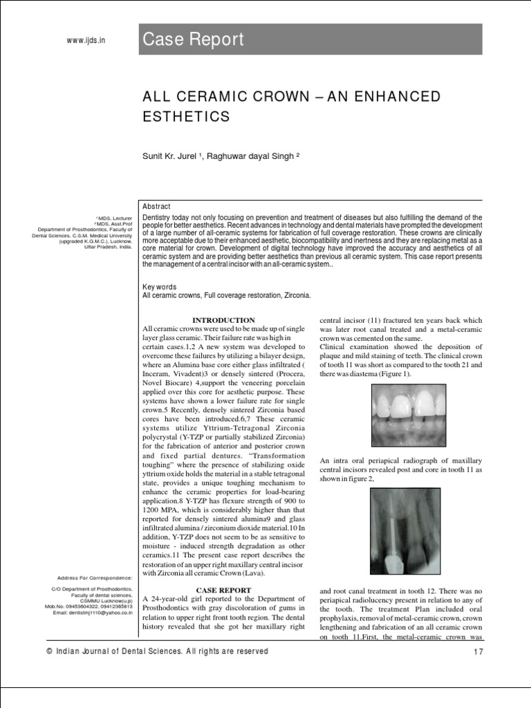 All Ceramic Crown | PDF | Dentistry | Mouth