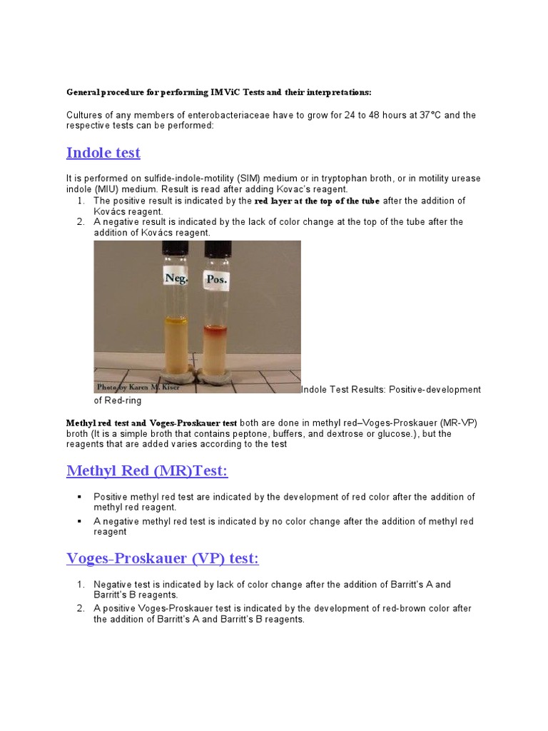 Indole Test: General Procedure For Performing Imvic Tests and Their ...