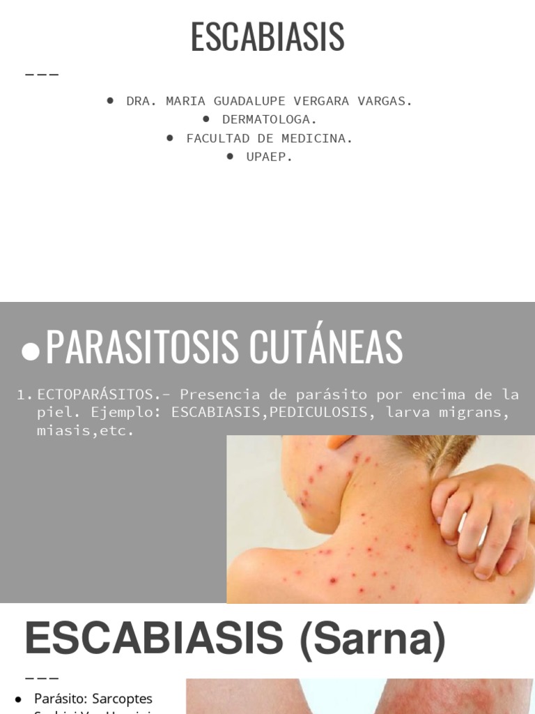 ESCABIASIS | PDF | Medicina | Enfermedades y trastornos