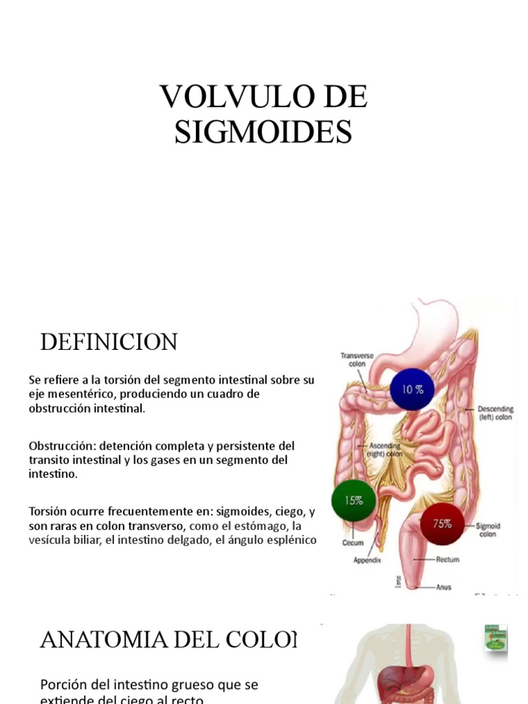 VOLVULO DE SIGMOIDES Expo | PDF