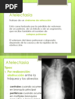 Niveles Axilares de Berg | PDF | Finanzas y administración del dinero