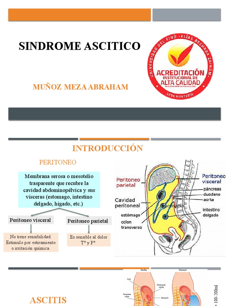 Sindrome Ascitico | PDF
